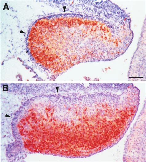 Calbindin Staining Of Sagittal Sections From E18 5 Cerebellum Reveals