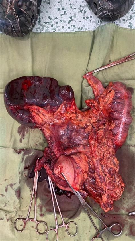 Emin Arakelians Rn Phn Bsn Bmsc Rdms Cst Posted On Linkedin