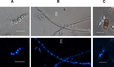 Dapi Staining For Detection Of The Nucleus In The Conidia A A