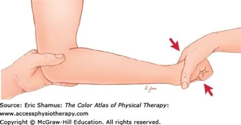 Lateral Epicondylitis Test Lateral Epicondylitis Tennis Elbow