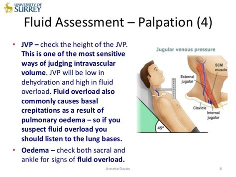 Fluid Assessment