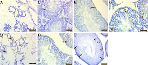 Tunel Staining In Testicular Tissues A Negative Control Tissue B