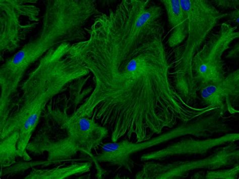 The Key Role Of Astrocytes In Cognitive Development Inserm Newsroom