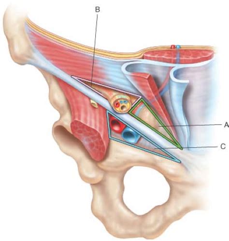 Prolene Hernia System Abdominal Key