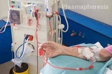 Plasmapheresis Machine