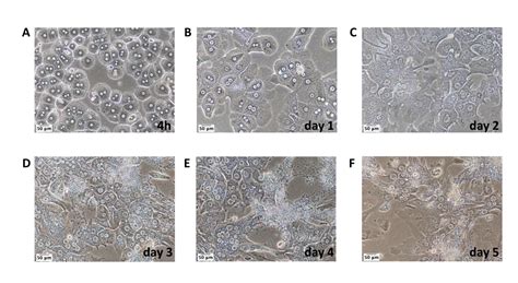 Rat Liver Perfusion And Primary Hepatocytes Isolation An Old Procedure Crucial For Cutting Edge