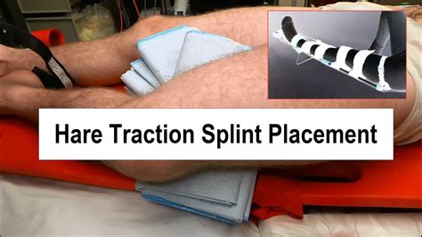 Indications Of Traction Splint At Louise Collier Blog
