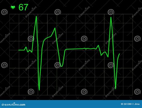 ECG Graph Stock Illustration Illustration Of Hospital 261280