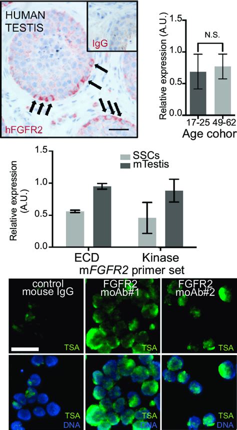 Expression Of Fgfr2 In Human Testis And In Mouse Sscs A Ihc With Expression Of Fgfr2 In Human Testis And In Mouse Sscs A Ihc With