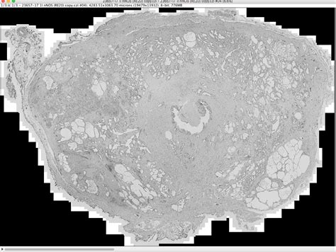 How To Open Czi File In Imagej Usage And Issues Imagesc Forum