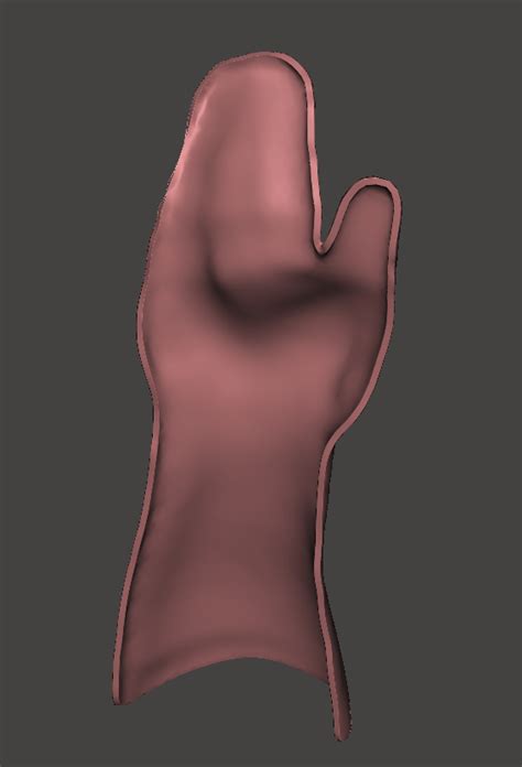 Free Stl File Arm Splint Forearm Splint 💪 ・3d Print Object To Download・cults