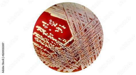 Staphylococcus Aureus Gram Positive To Gram Variable Nonmotile Coccus Beta Hemolysis