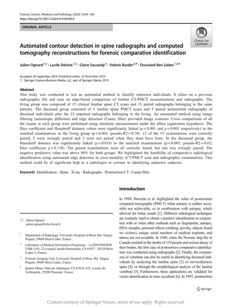 automated contour detection in spine radiographs and computed tomography reconstructions for