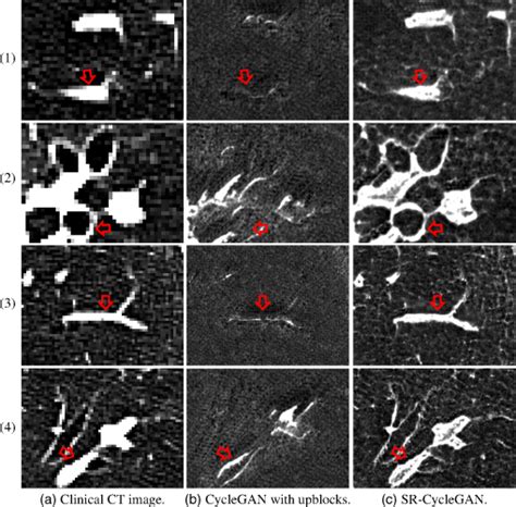 Sr Cyclegan Super Resolution Of Clinical Ct To Micro Ct Level With Multi Modality Super
