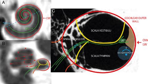 Cochlear Duct Length Metrics Outcomes A Value Organ Of Corti Download Scientific Diagram