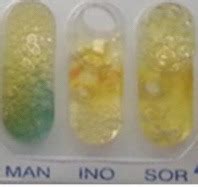 Catalase Flashcards Quizlet