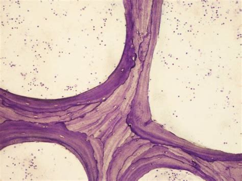 Histologia Do Osso Trabecular