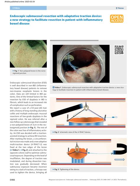 Pdf Endoscopic Submucosal Resection With Adaptative Traction Device A New Strategy To