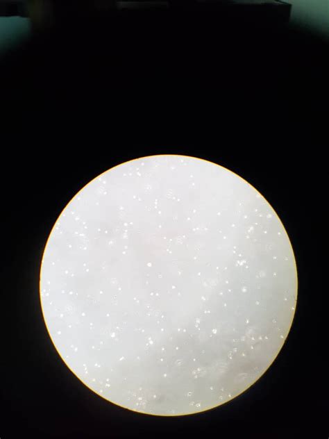 How Do I Save My Hepg2 Cell Line Researchgate