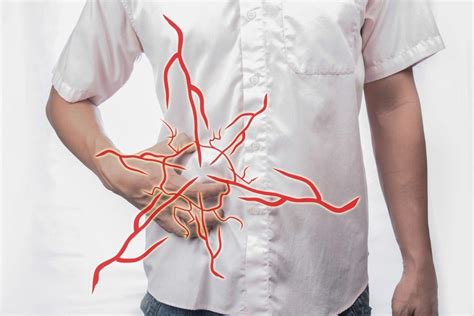 What Is A Hernia Hernia Symptoms Familydoctor Org