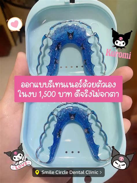 ทำรีเทนเนอร์ในงบไม่เกิน 2 แบงค์เทา💗 แกลเลอรีที่โพสต์โดย Sskobb Lemon8