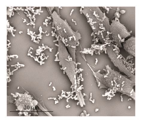 Scanning Electron Microscope Images Of Vaginal Epithelial Cells Treated Download Scientific