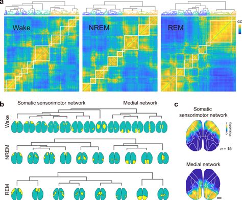 Anterior Posterior Organization Of Cortical Activity During Sleep A Download Scientific Diagram