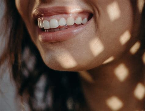 Have An Overbite Fixing It May Prevent Future Dental Problems Wellistic