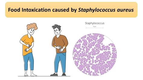 Food Intoxication Caused By Staphylococcus Aureus Microbiology Notes