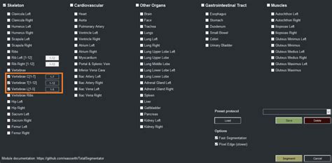 Ai Segmentation Daniel Lafontaine