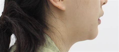 서울동안의원 커뮤니티 사례 And 후기