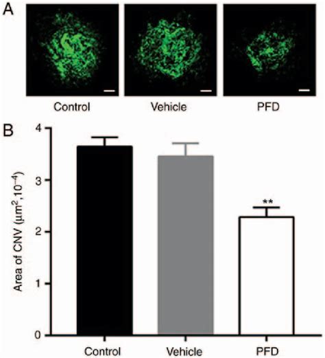 Intravitreal Injection Of Pfd Attenuates The Formation Of Cnv A Download Scientific Diagram
