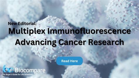 New Article On Multiplex Immunofluorescence For Cancer Research Biocompare Posted On The Topic