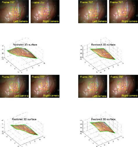 Figure 1 From Motion Tracking For Beating Heart Based On Sparse Statistic Pose Modeling