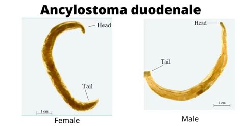 Hookworm Characteristics Life Cycle Pathogenesis And Diagnosis