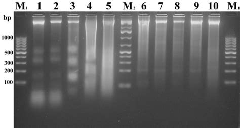 Dna Ladderingfragmentation Assay For The Dna Extracted From Thymus Of