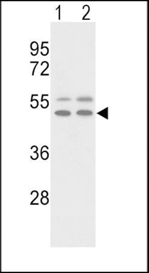 Vitronectin Polyclonal Antibody Invitrogen™ 400 μl Unconjugated