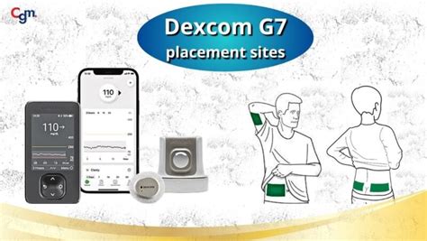 Dexcom G7 Placement Sites Thigh Arm Or Abdomen [ 2023 ]