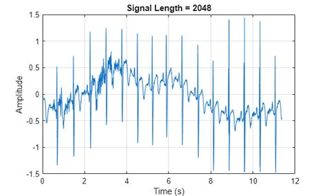 Maximal Overlap Discrete Wavelet Transform Matlab Modwt