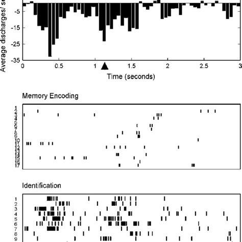 Area Of Lateral Temporal Cortex Where Recordings Were Obtained