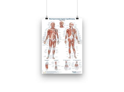 Trigger Points Τι είναι και πώς αντιμετωπίζονται