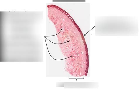 Example Of The Skin Diagram Quizlet