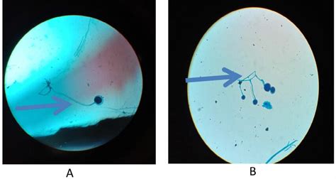 A And B Lpcb Mount Showing Rhizopus Rhizoids Seen In Picture A Bunch Download Scientific