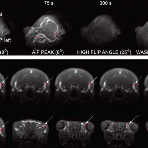 selection of vascular voxels for the arterial input function was based