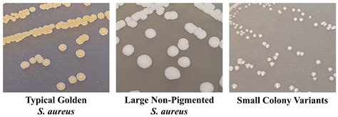 Phenotypic Variation In Staphylococcus Aureus During Colonisation Involves Antibiotic Tolerant
