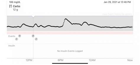Dexcom Sensor Error During Warm Up Sensor Center Website