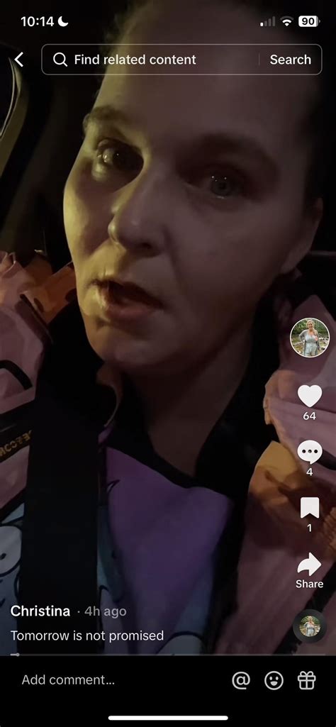 Crusty Why Dont U Worry Bout Urself And Wth Is On Ur Forehead R Simplychristina87