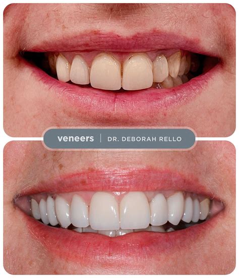 Deborah Rello Posted On Linkedin