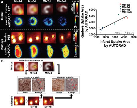 A Left Upper Rows In Mice After Myocardial Infarction Mi In Vivo Download Scientific