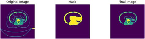 noise removal and segmentation script on ct scan from the nmdid